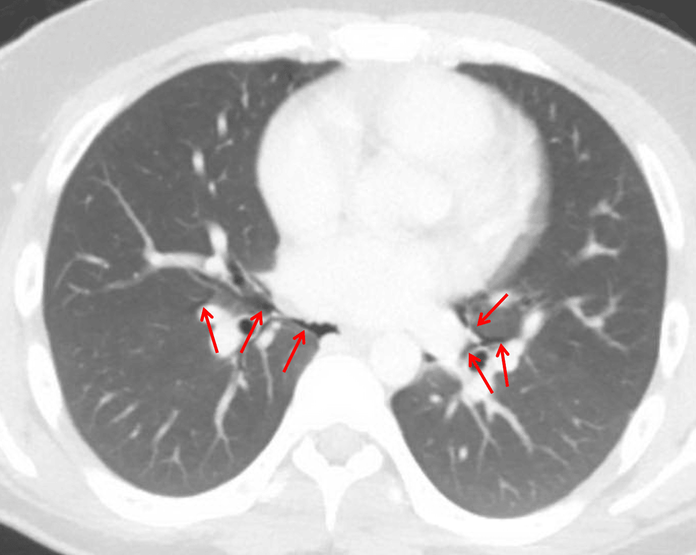 Radiology Case #5 | CaseStacks