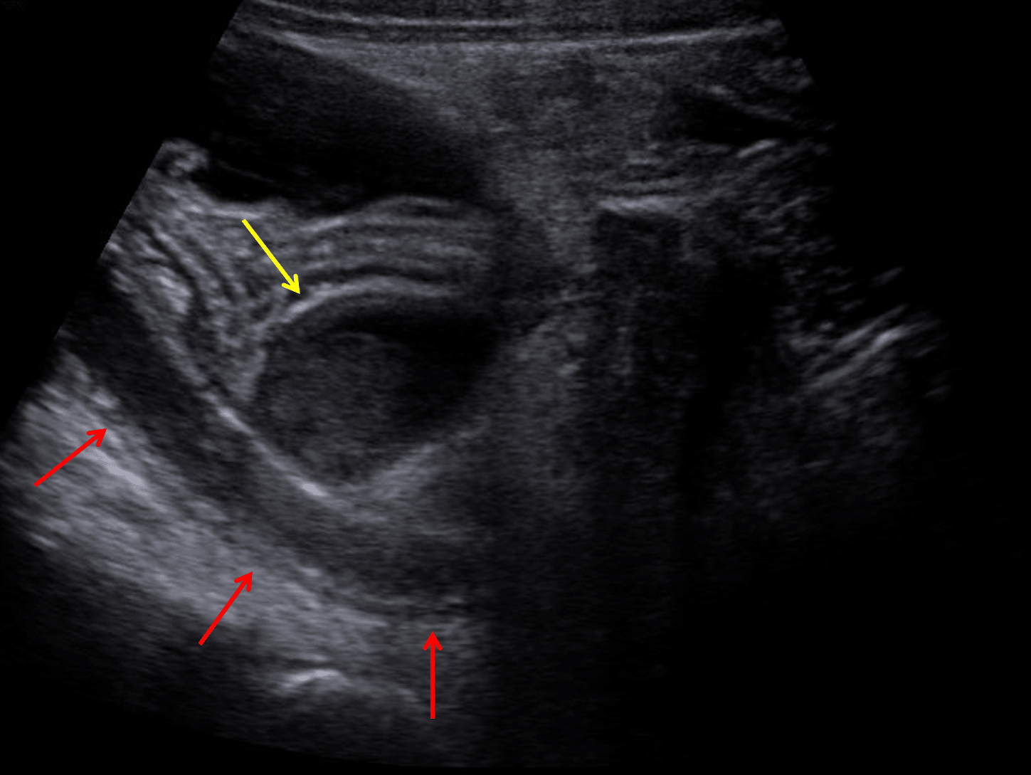 Radiology Case #1 | CaseStacks